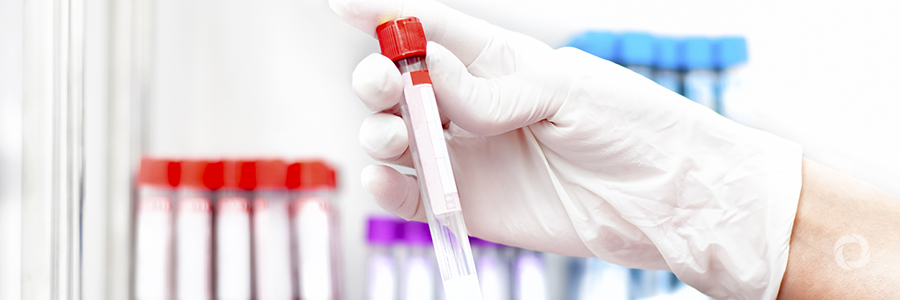 First-ever WHO list of essential diagnostic tests to improve diagnosis ...