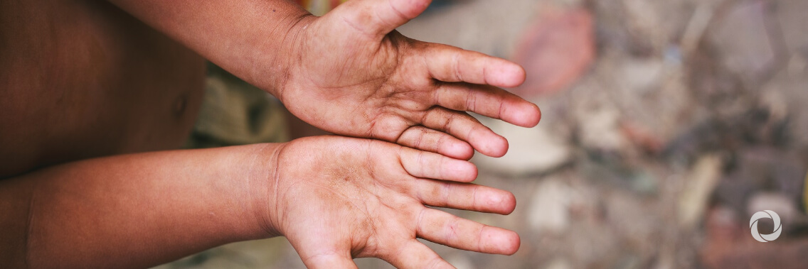 Window to prevent famine in Yemen is narrowing, UN agencies warn ...