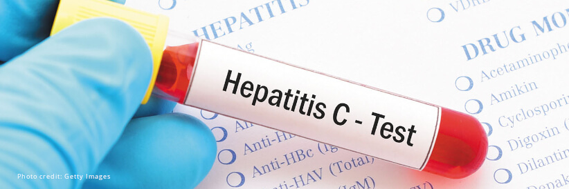 WHO prequalifies the first self-test for hepatitis C virus DevelopmentAid