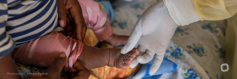 Mpox: Five ways children are more at risk DevelopmentAid