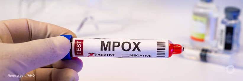 IFRC announces CHF 40 million appeal as Africa faces surge in mpox ...